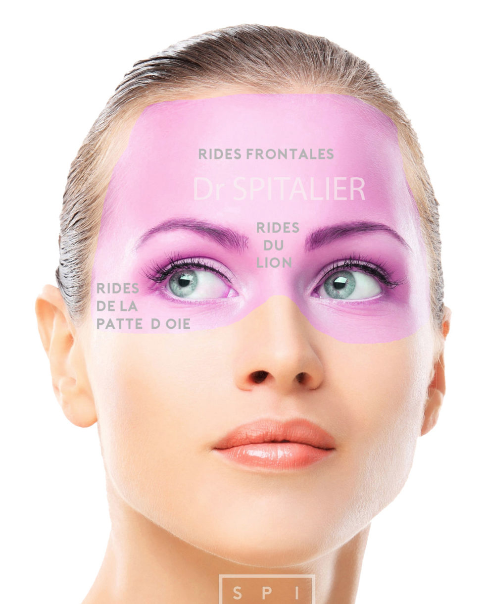 Injections de Botox(toxine botulique).Annecy Haute Savoie Dr Spitalier